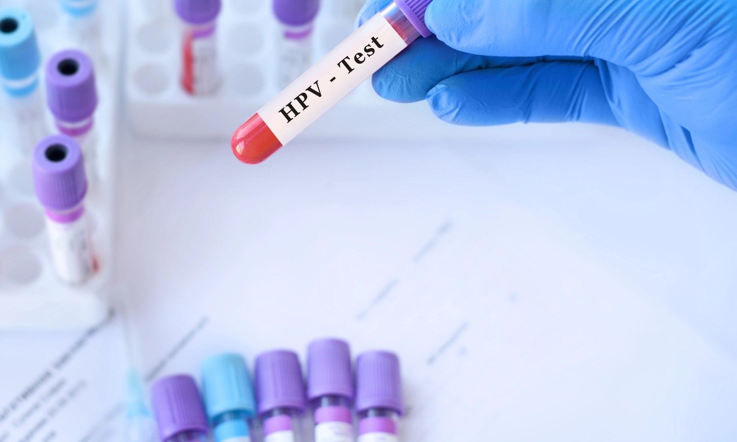 Does Quick Care Do STD Testing in Shenandoah? | Advanced STD Testing ...
